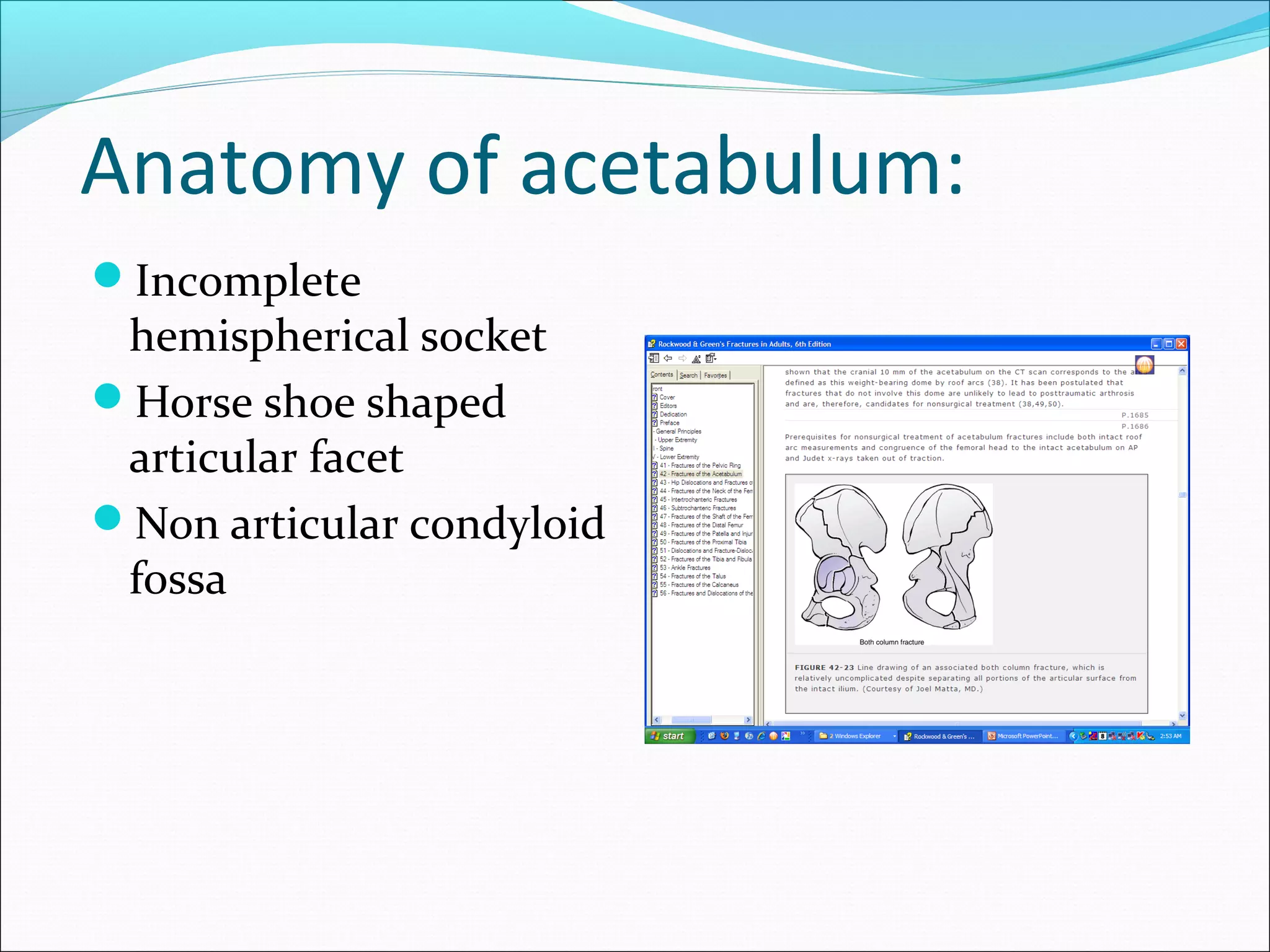 Acetabulum fractures | PPT
