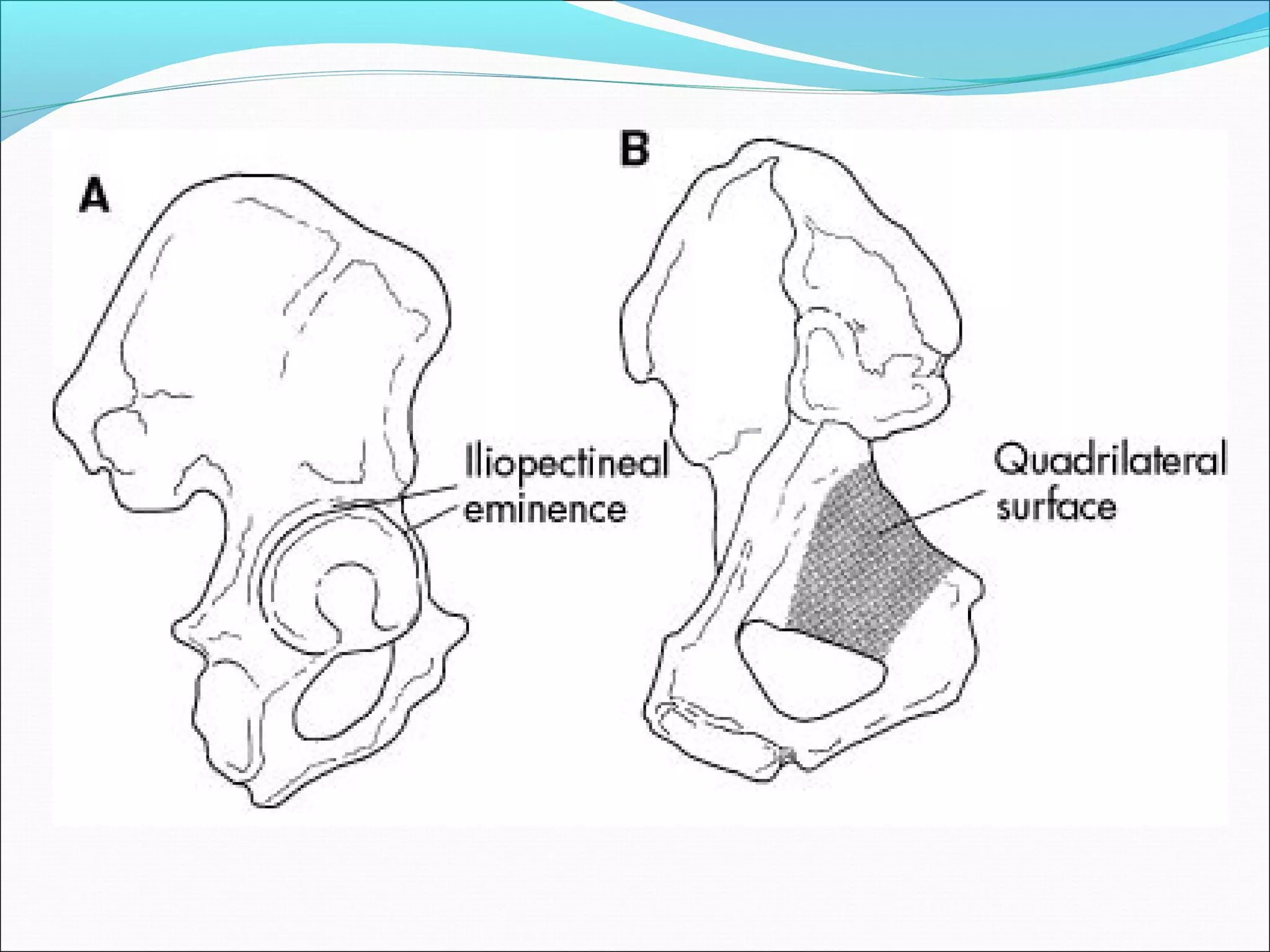 Acetabulum fractures | PPT