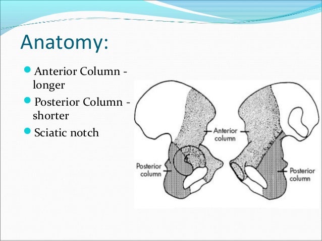 Acetabulum fractures