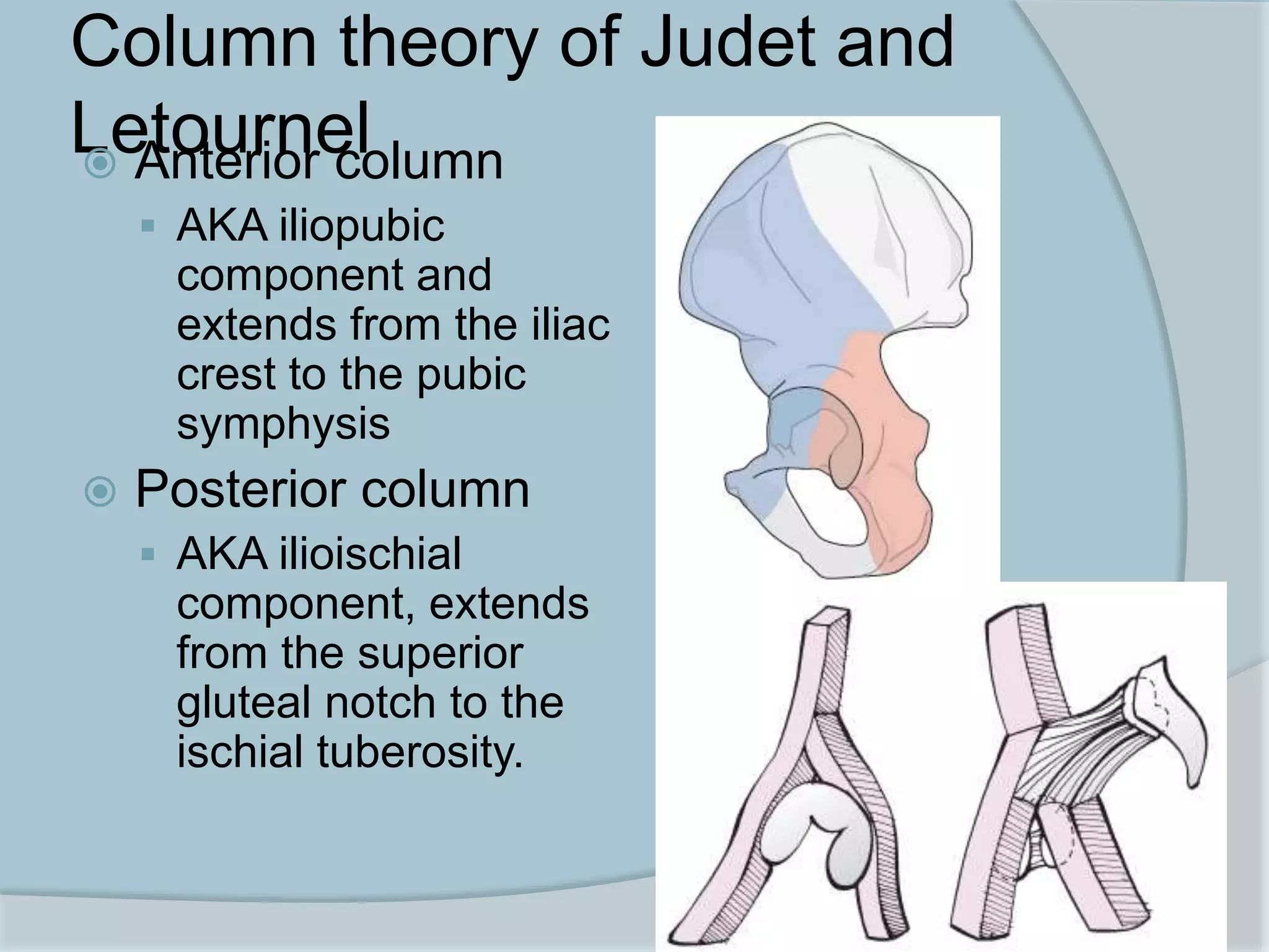 Acetabulum fractures | PPTX