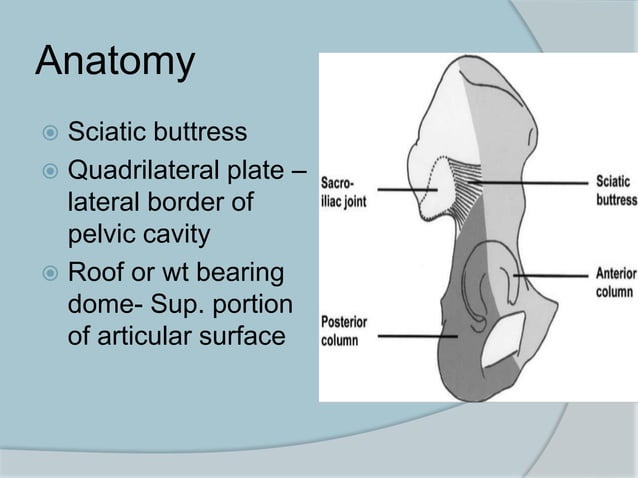 Acetabulum fractures | PPT