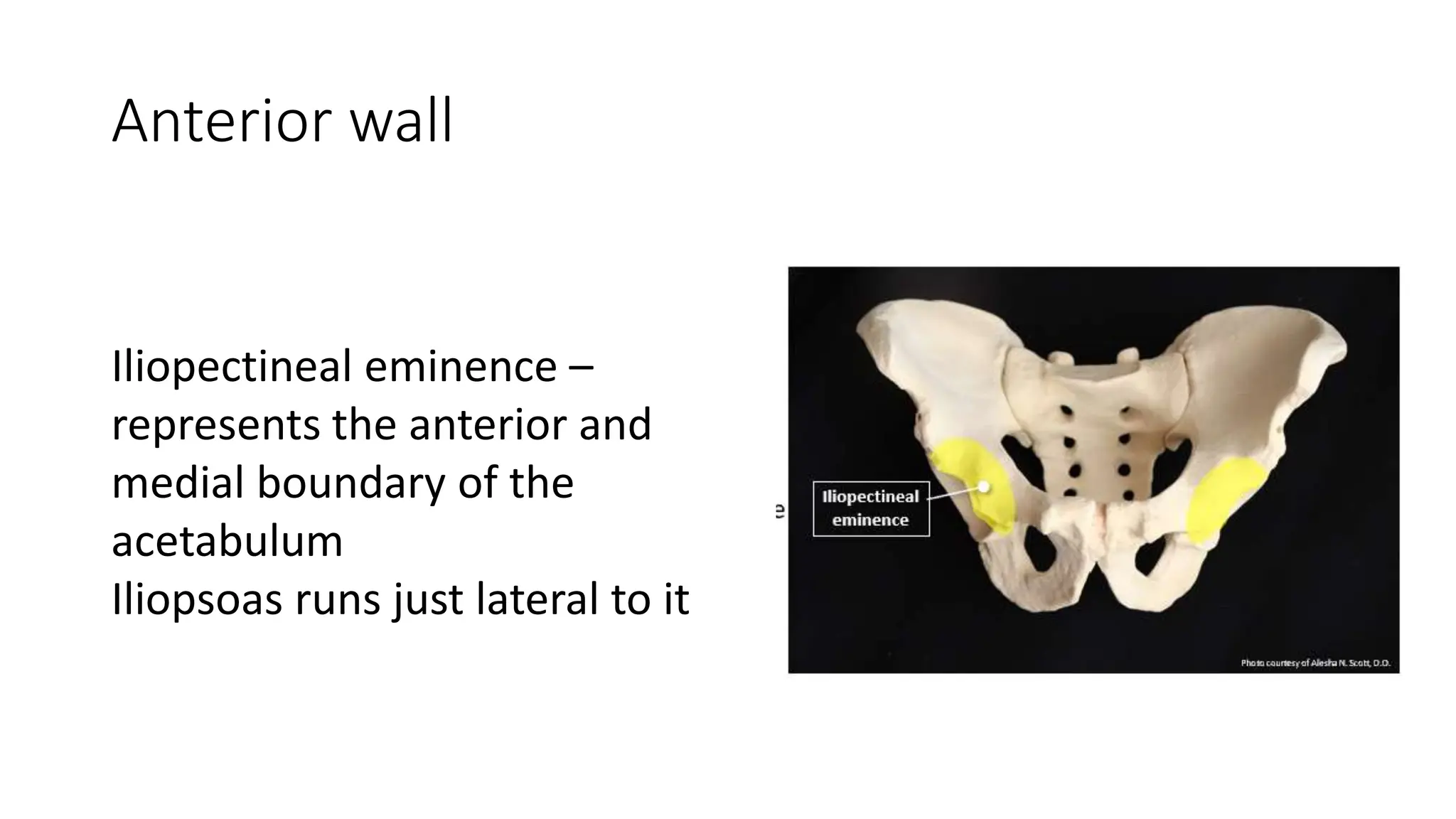 Acetabulum Fractures - Anatomy, Radiological Evaluation, Classification ...