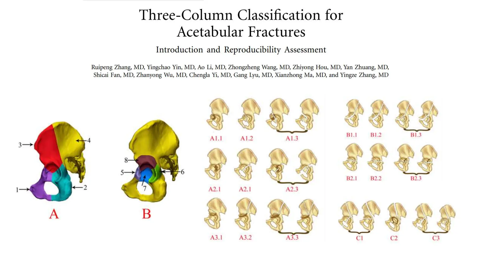 Acetabulum Fractures - Anatomy, Radiological Evaluation, Classification ...