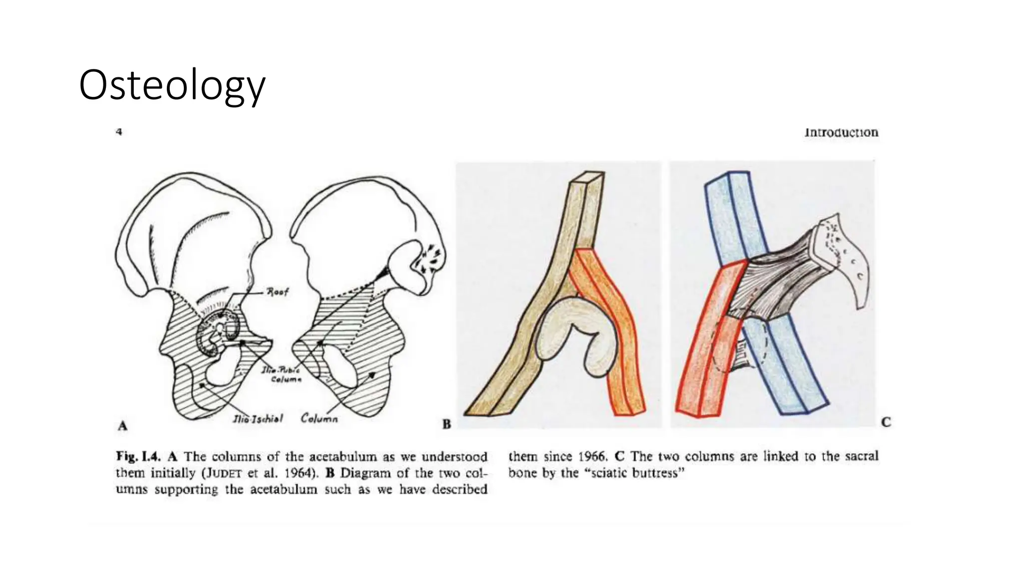 Acetabulum Fractures - Anatomy, Radiological Evaluation, Classification ...