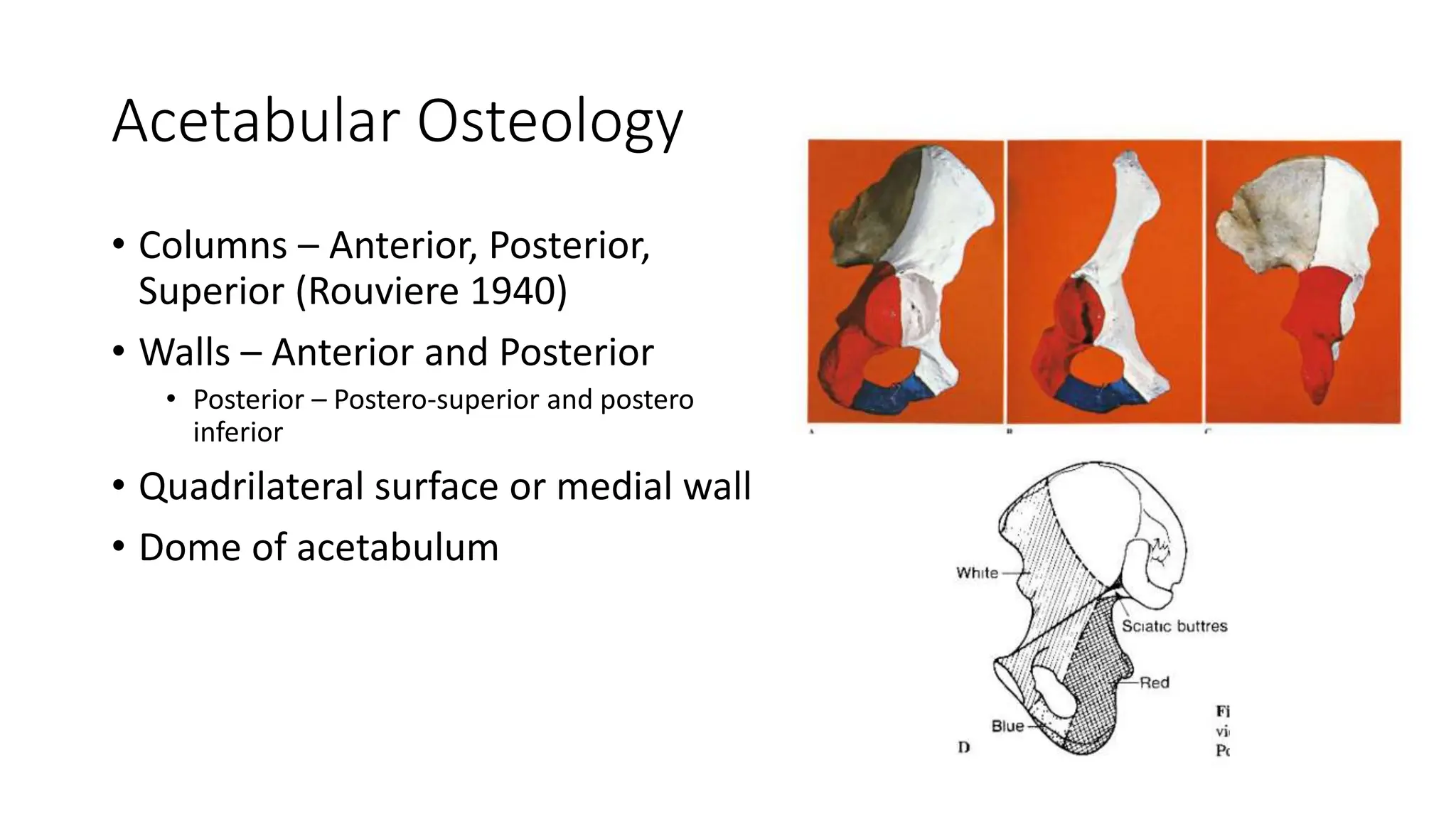 Acetabulum Fractures - Anatomy, Radiological Evaluation, Classification ...