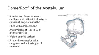Acetabulum Fractures - Anatomy, Radiological Evaluation, Classification ...