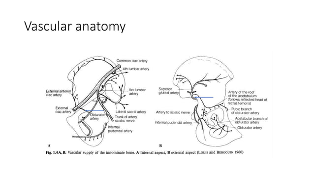 Acetabulum Fractures - Anatomy, Radiological Evaluation, Classification ...