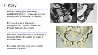 Acetabulum Fractures - Anatomy, Radiological Evaluation, Classification ...