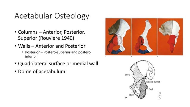 Acetabulum Fractures - Anatomy, Radiological Evaluation, Classification ...