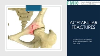 Acetabulum Fractures (in Pediatrics).pptx