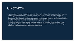 Acetabulum Fractures (in Pediatrics).pptx