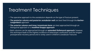 Acetabulum Fractures (in Pediatrics).pptx
