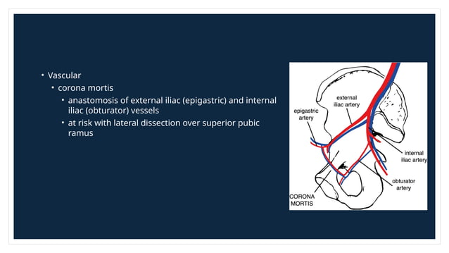 Acetabulum Fractures (in Pediatrics).pptx
