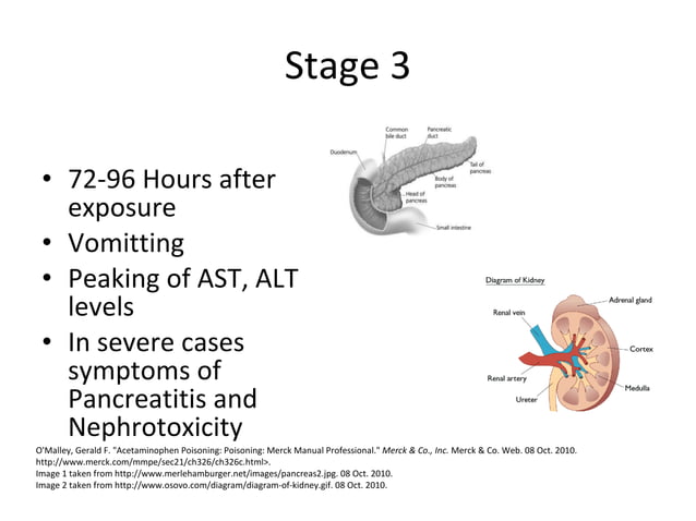 Acetaminophen (APAP) Toxicity: Clinical Cases, Diagnosis, Pathology ...