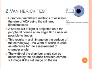 Anterior Chamber : Anatomy , Aqueous Production & Drainage | PPTX