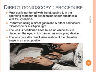 Anterior Chamber : Anatomy , Aqueous Production & Drainage | PPTX