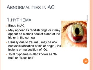 Anterior Chamber : Anatomy , Aqueous Production & Drainage | PPTX