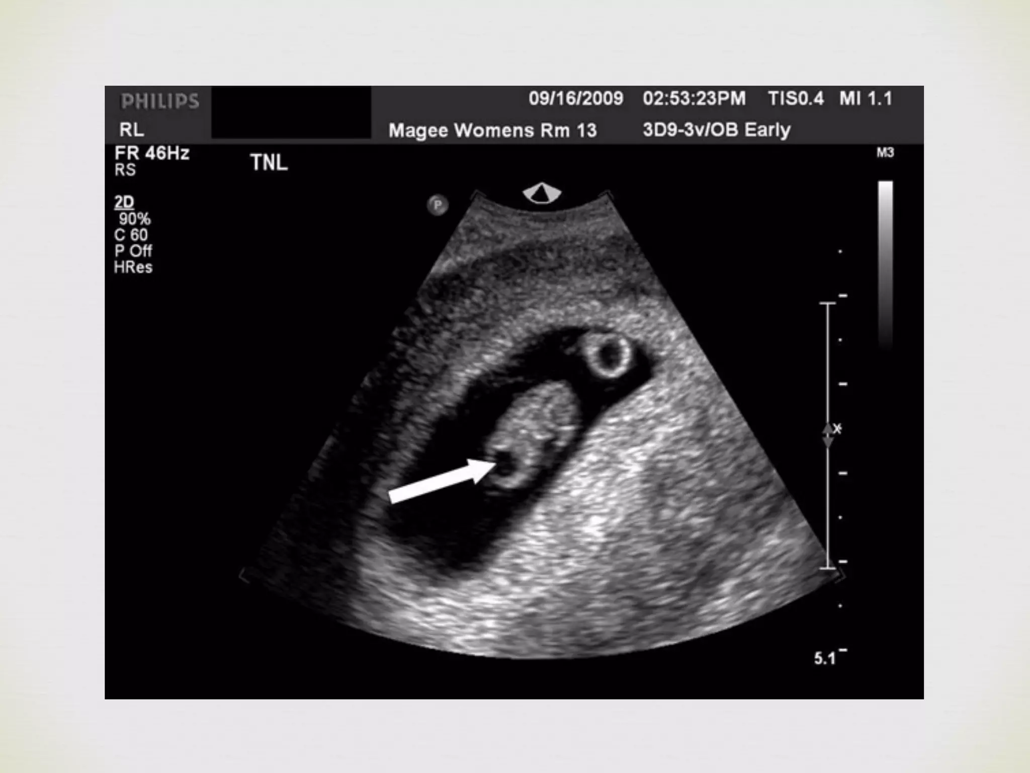 obstetric ultrasound | PDF
