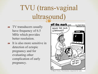 obstetric ultrasound | PDF | Infertility | Reproductive Health