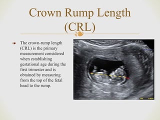 obstetric ultrasound | PDF | Infertility | Reproductive Health