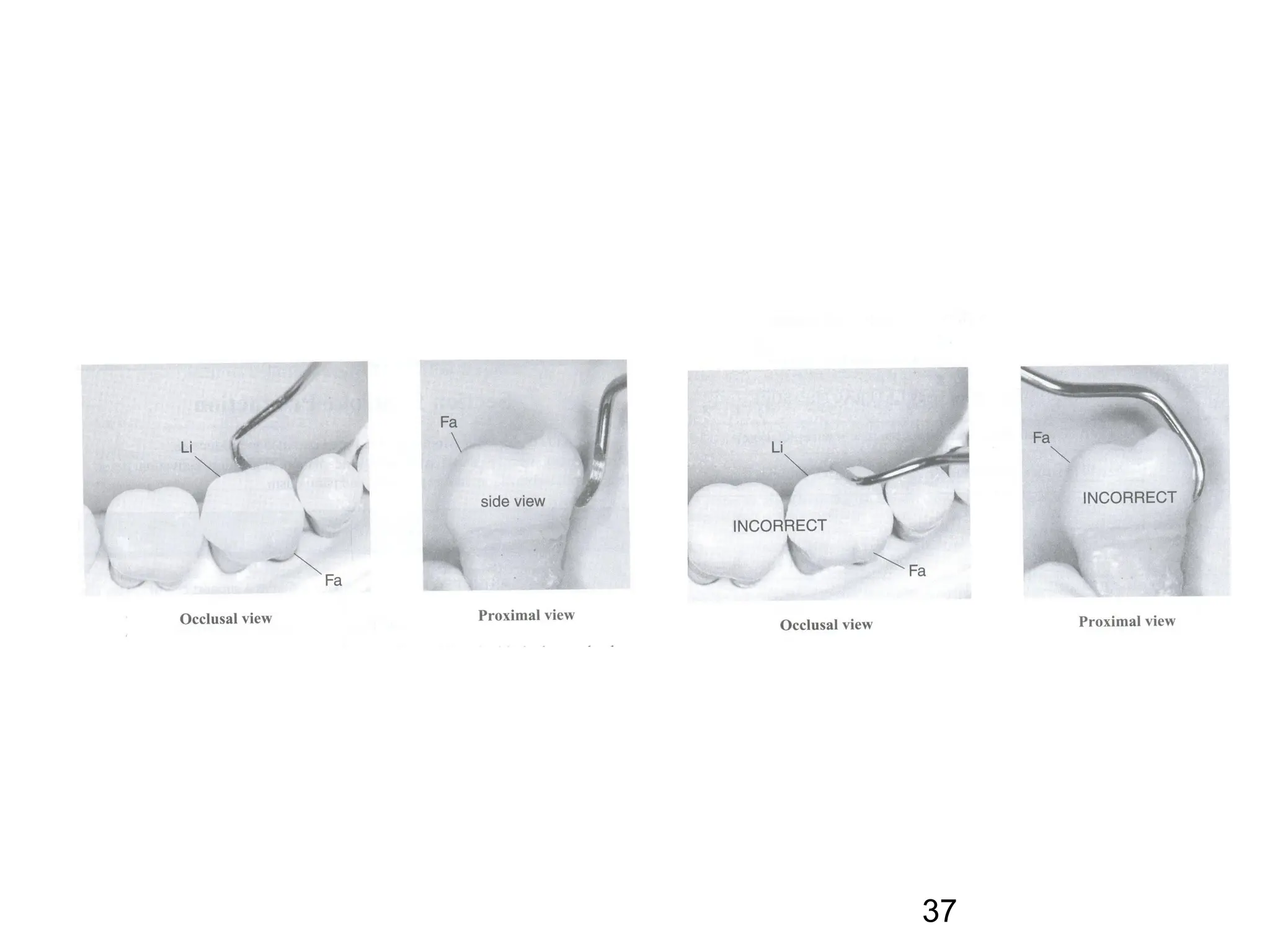 Principles of instrumentation in periodontology.pdf