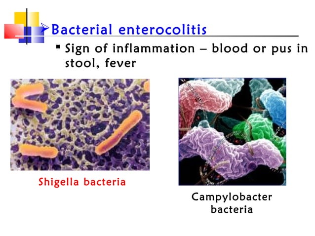 Acute diarrhea in children MBBS Lecture