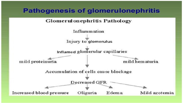 Acute glomerulonephritis in children | PPTX | Blood Disorders ...
