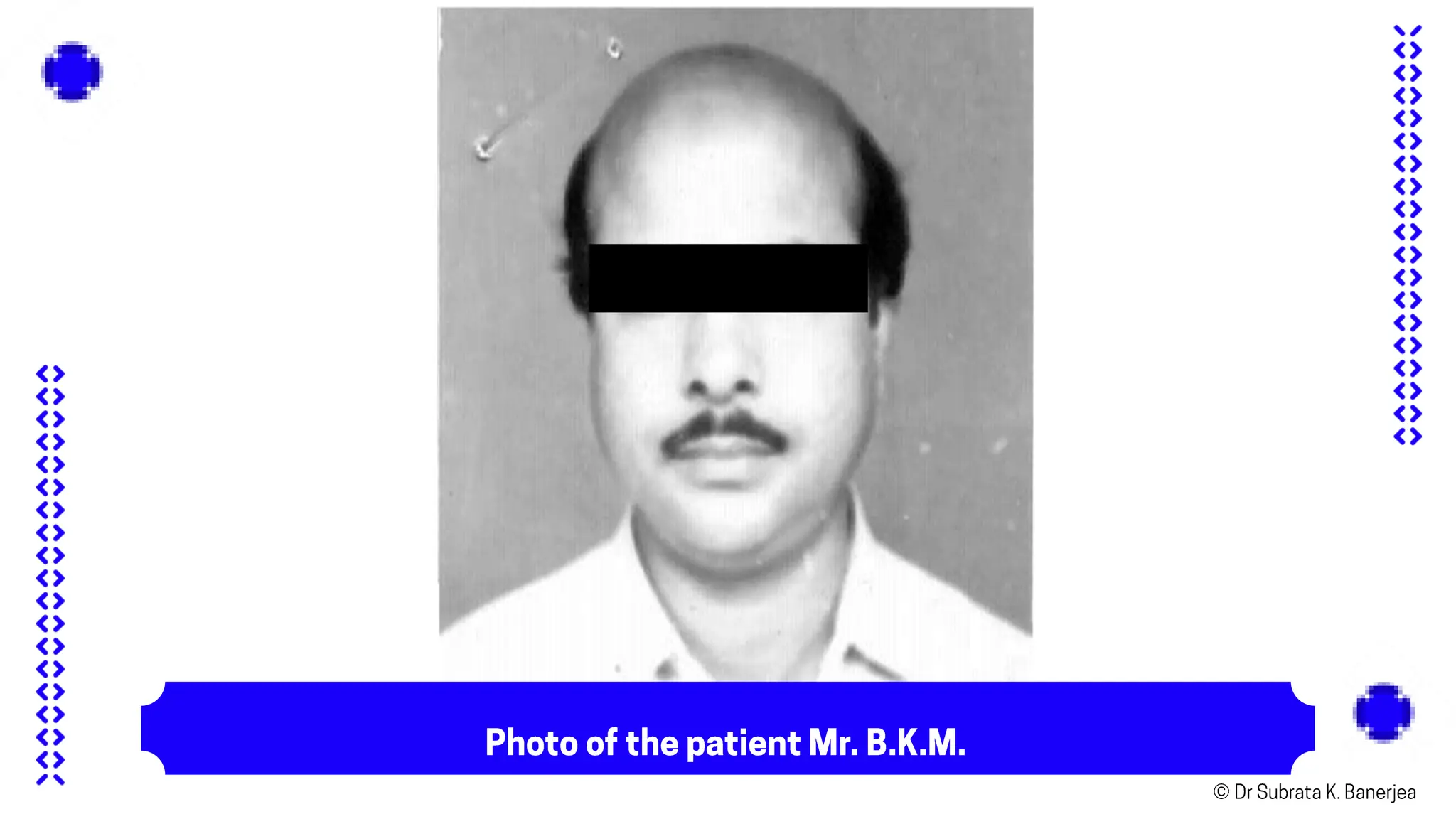 ACH - CURED CASE PPT - E010-HYPERTHYROIDISM-BKM.pptx