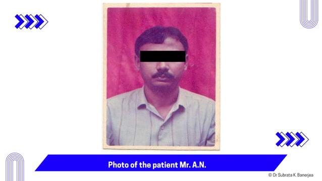 ACH - CURED CASE PPT - GA015-SUB-MANDIBULAR DUCT CALCULI-AN.pptx