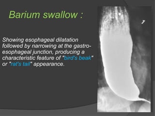 Achalasia | PPTX