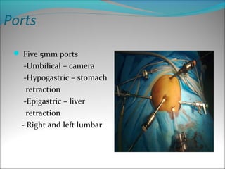 Achalasia cardia 2003 | PPT