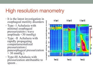 Achalasia High Resolution Manometry