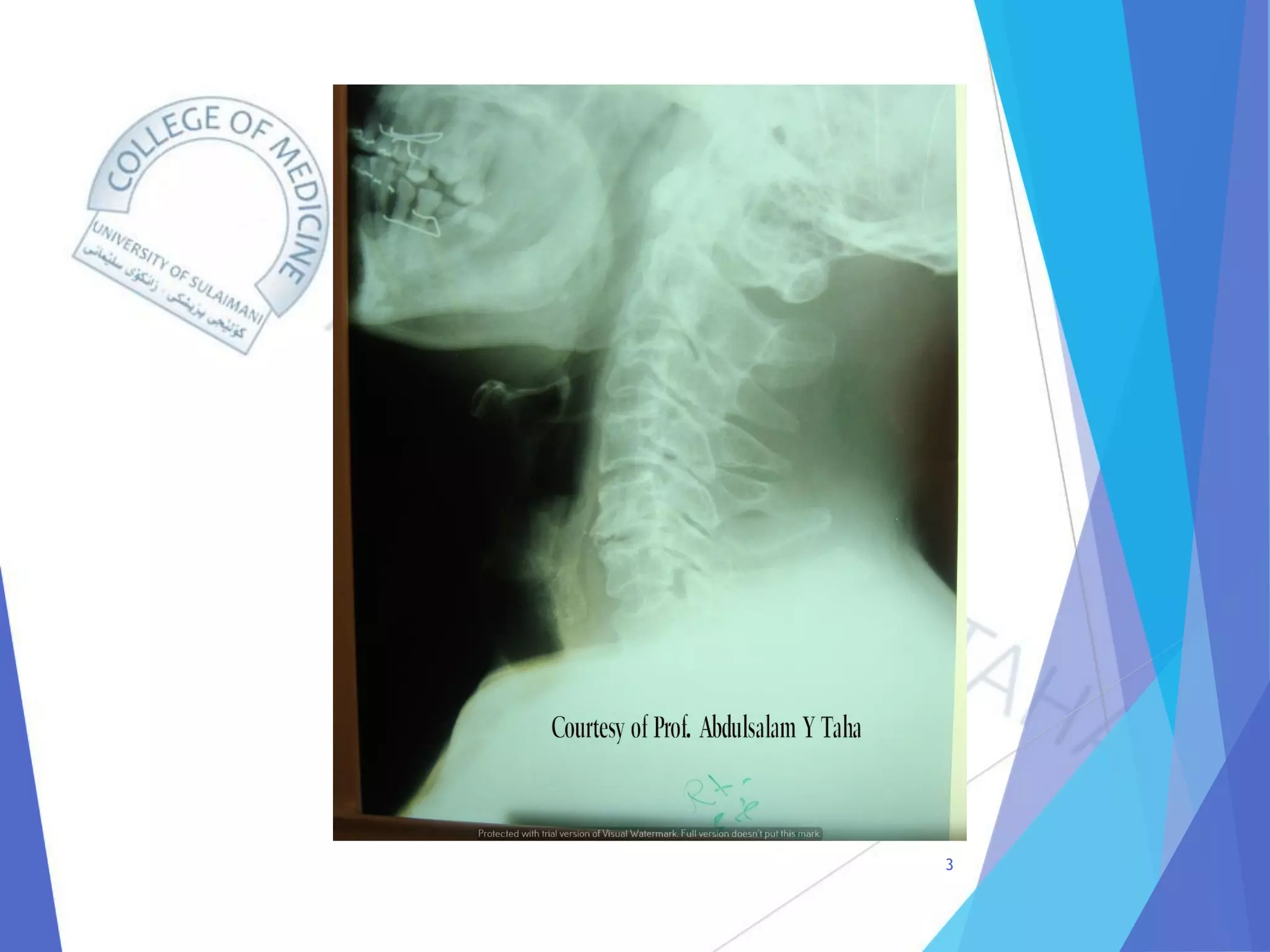 Achalasia Cardia Workup.pdf