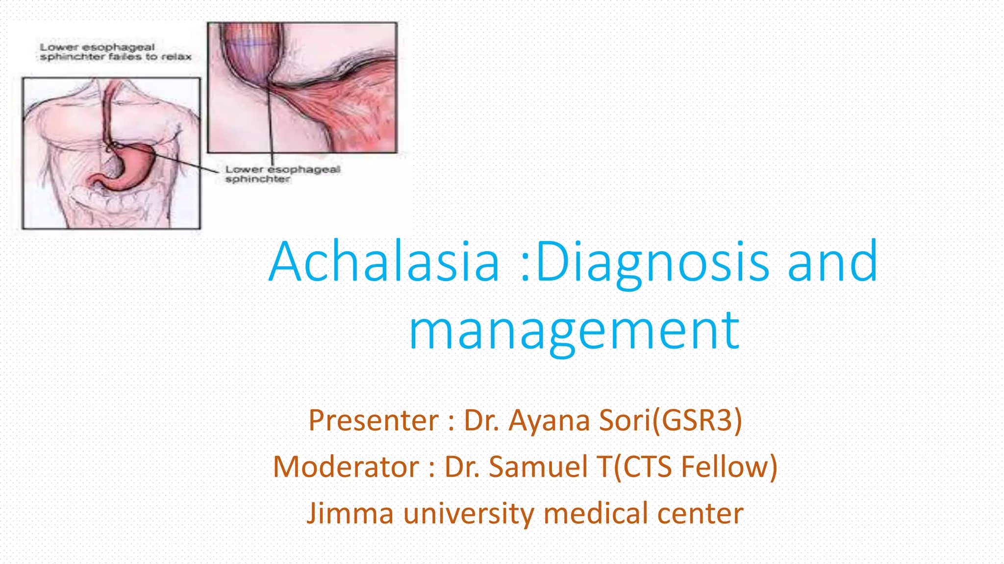 Achalasia management ay | PPTX