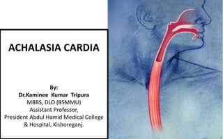 Achasia Cardia.pptx