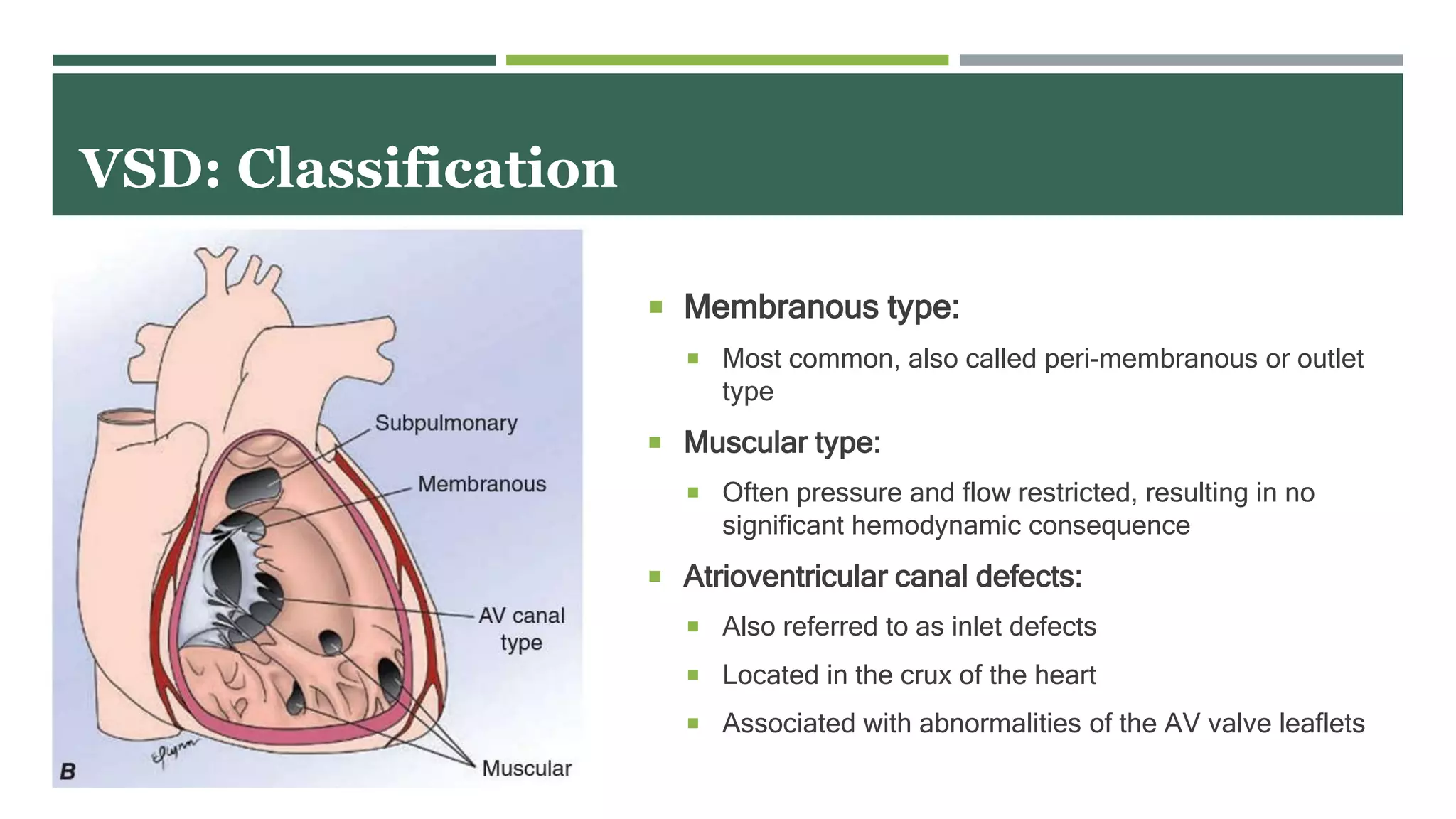 Acyanotic congenital heart disease | PPTX