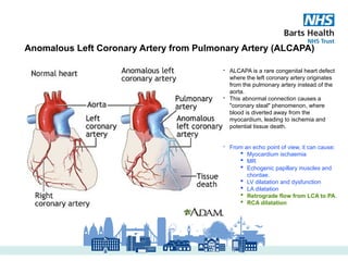 ACHD Presentation_Anomalous left coronary artery to pulmonary artery | PPTX