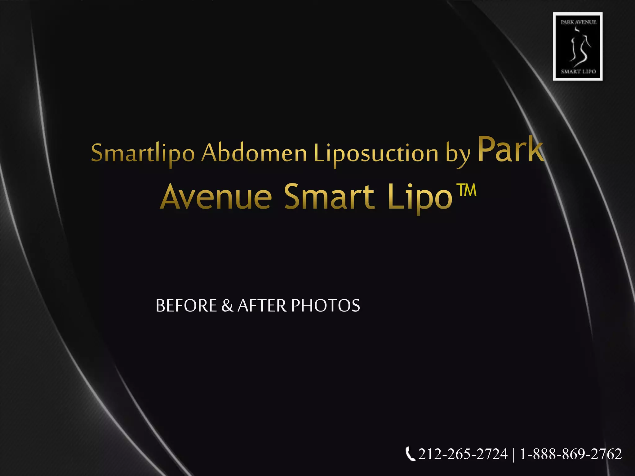 Achieve a truly masculine look with abdomen liposuction using smartlipo triplex | PPTX