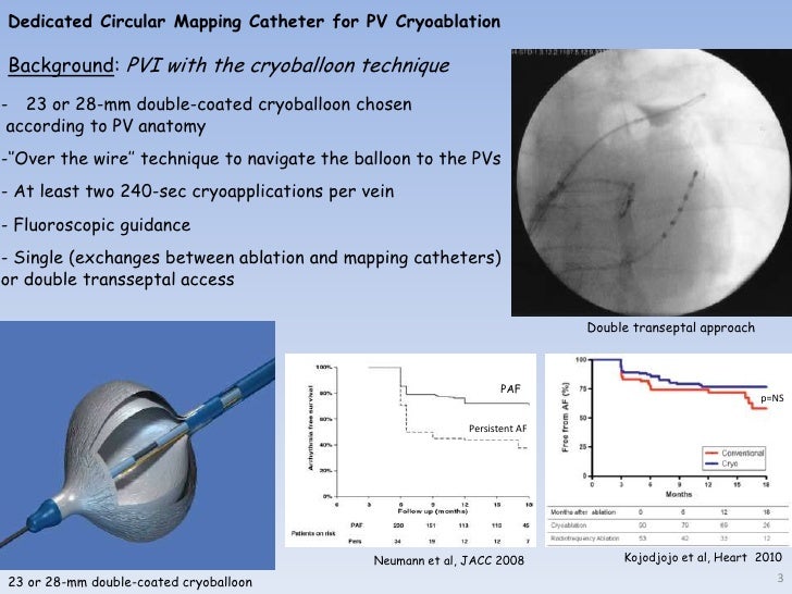 The Use of Achieve Circular Mapping Catheter Significantly Reduces Pr… The Use of Achieve Circular Mapping Catheter Significantly Reduces Pr…