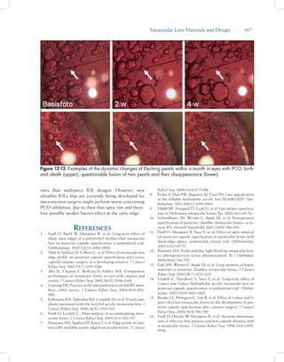 Achieving Excellence in Cataract Surgery | PDF