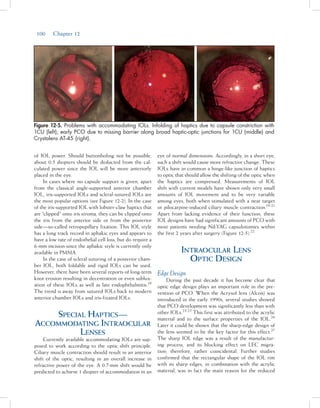 Achieving Excellence in Cataract Surgery | PDF | Eye and Vision ...