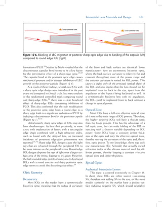 Achieving Excellence in Cataract Surgery | PDF