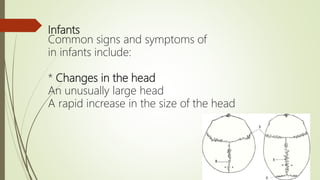 A child with a Large head | PPT