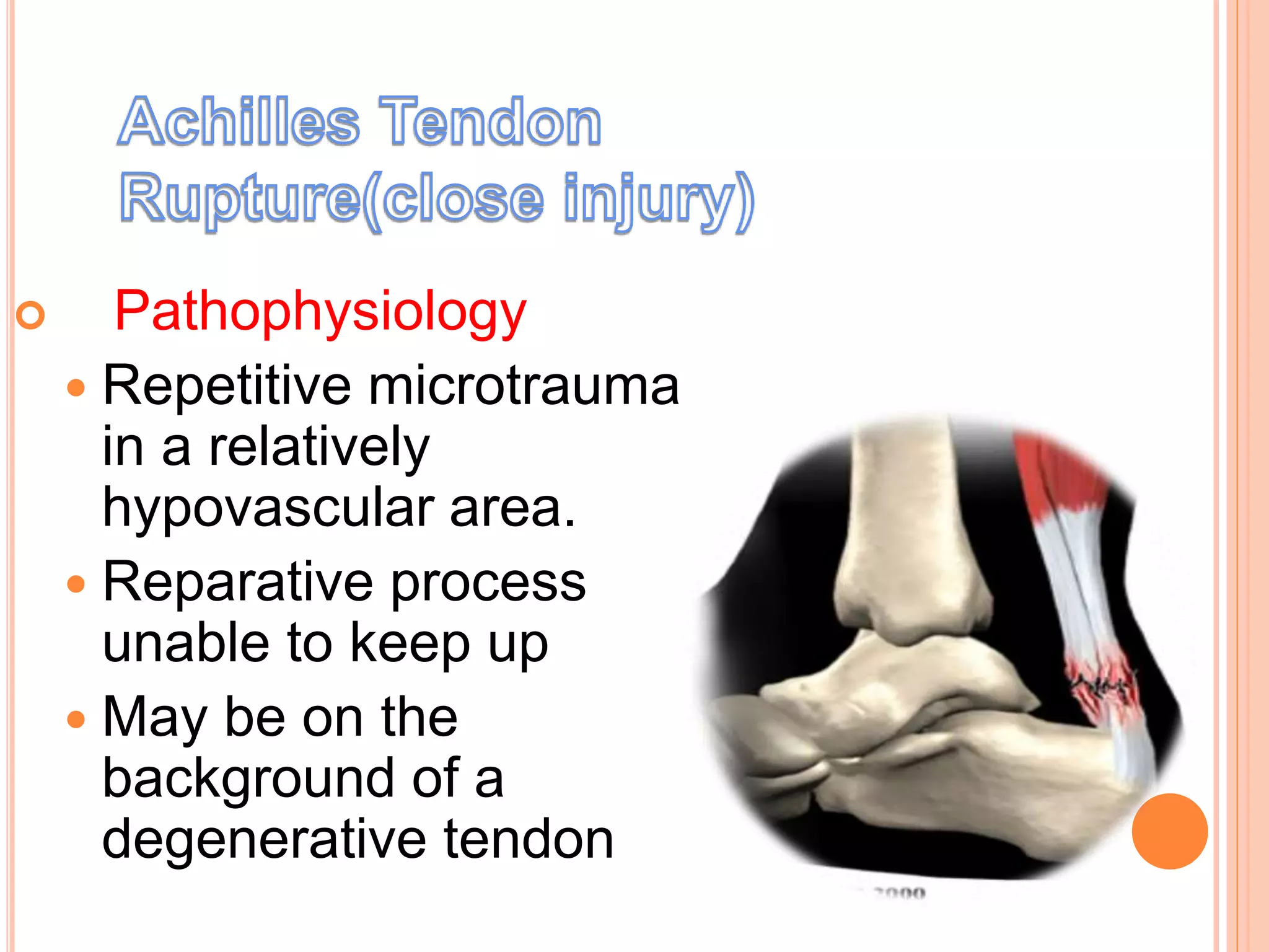 Achilis tendon rupture I Dr.RAJAT JANGIR JAIPUR | PPTX