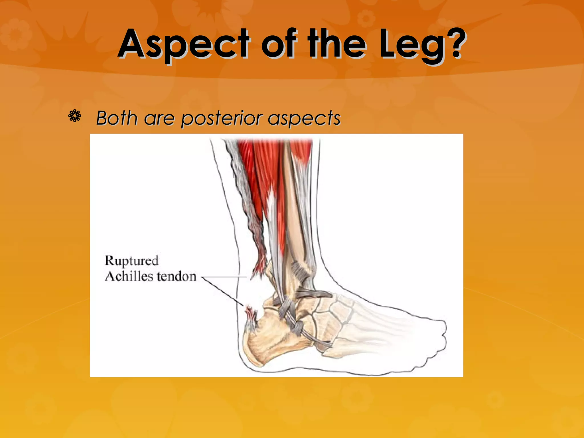 Achilles Tendonitis/Rupture | PPT