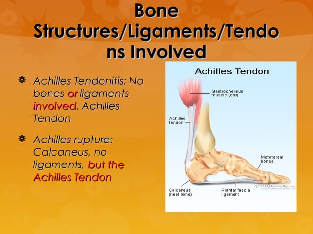 Achilles Tendonitis/Rupture | PPT