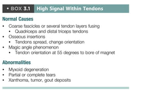 Achilles tendon pathology and trauma radiology | PDF