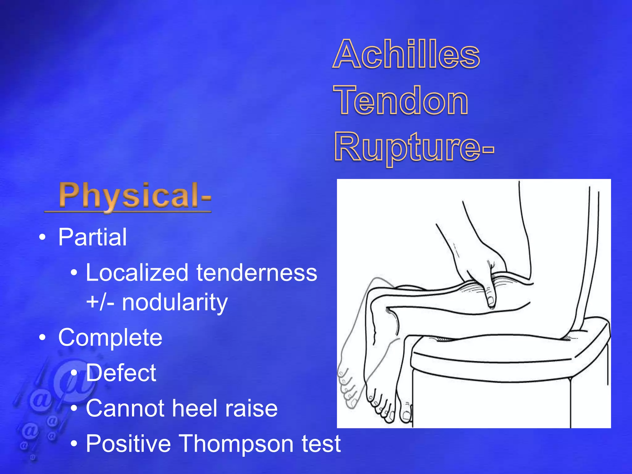 Achilles rupture | PPTX