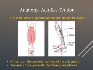 Achilles Reflex Diagram