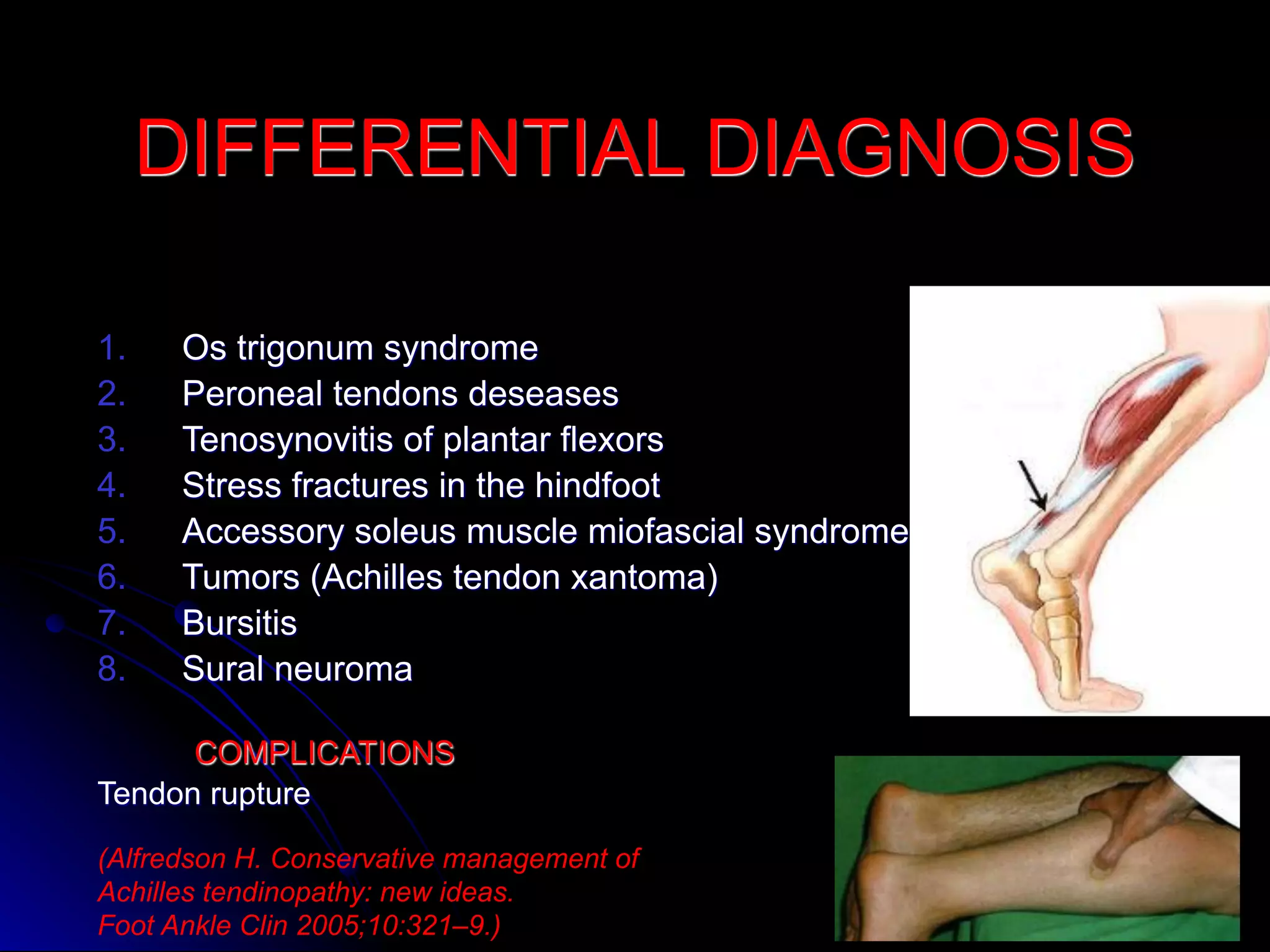 Achilles tendinopathy treatment with triple therapy | PDF